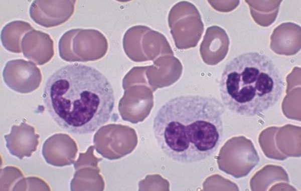 Bạch cầu mono - Ý nghĩa khi xét nghiệm máu